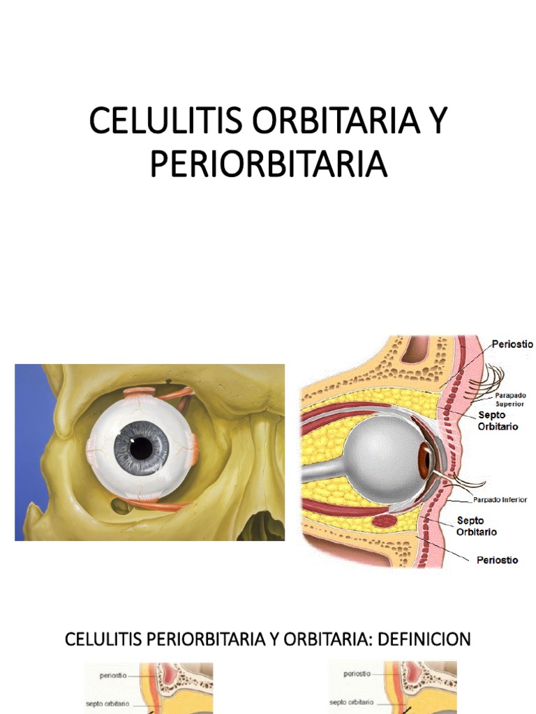 Celulitis Orbitaria y Periorbitaria | PDF | Medicina | Enfermedades y ...