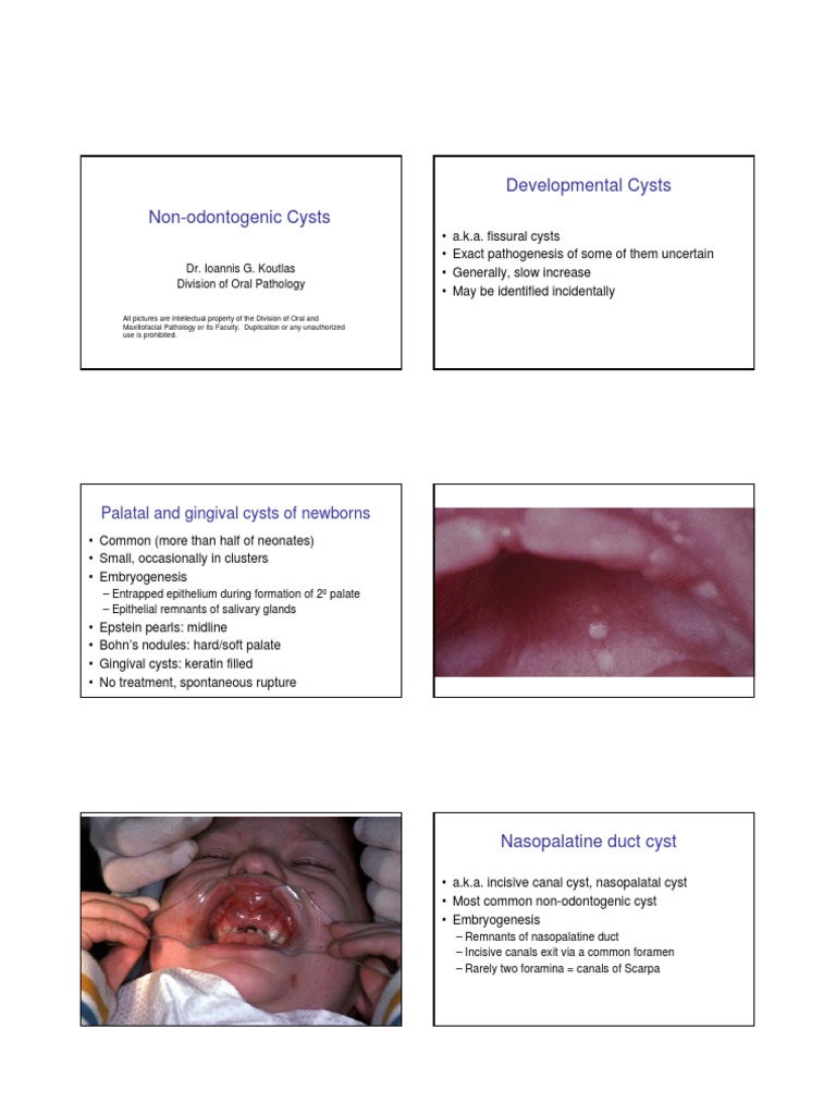26 Non-Odontogenic Cysts | Epithelium | Anatomy