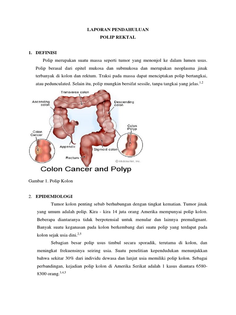 Laporan Pendahuluan Polip Rektal | PDF