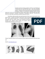 Contusio Musculorum | PDF