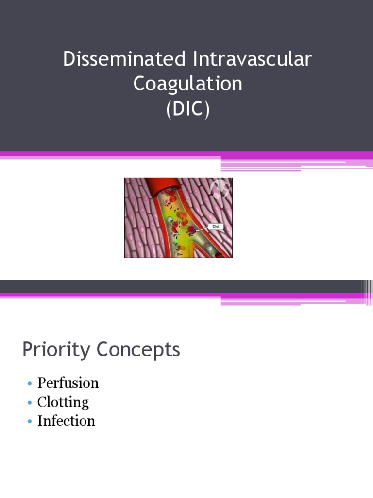 Disseminated Intravascular Coagulation | PDF | Coagulation | Bleeding