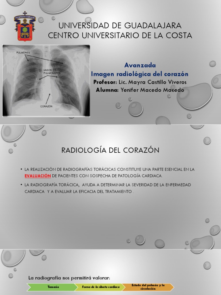 Radiologia Del Corazon | PDF