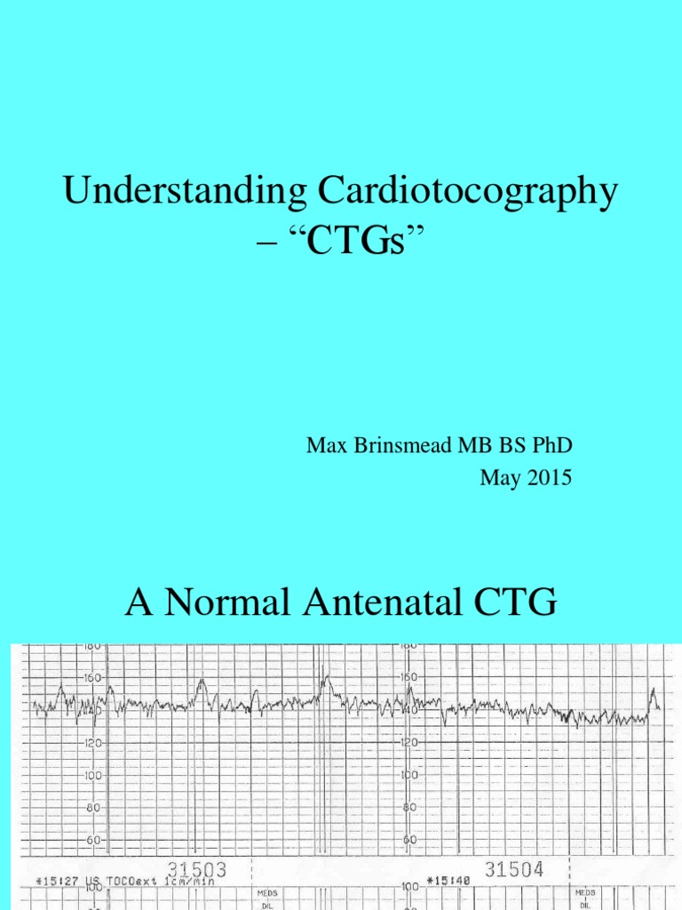 CTG Understanding | PDF | Medical Specialties | Clinical Medicine