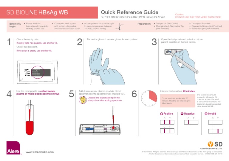 120003168e v01 SD Bioline Hbsag WB Quick Reference Gu | PDF | Blood ...