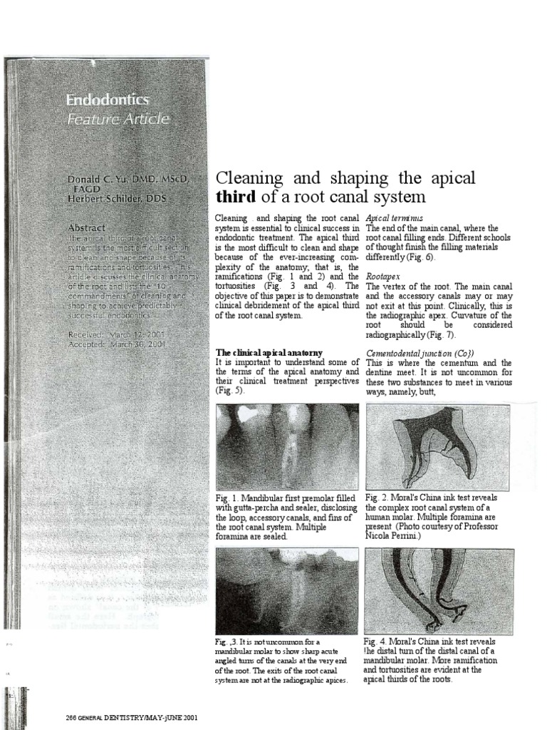 Cleaning and Shaping the Apical Third[1] | Dentistry | Dentistry Branches