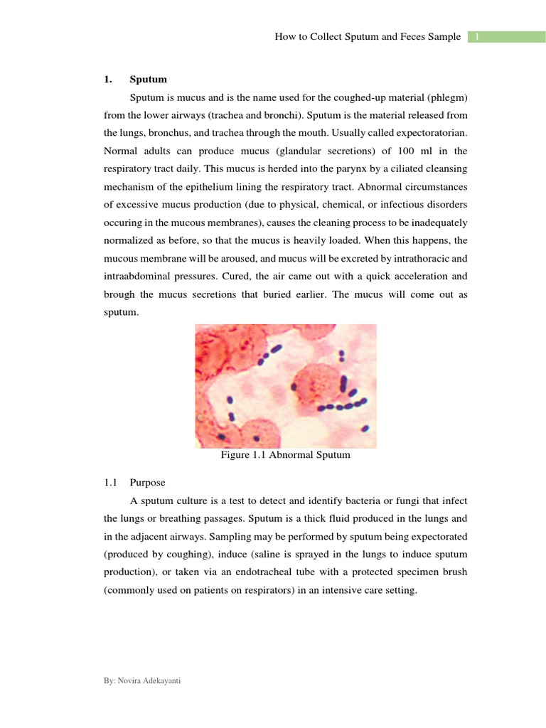 Sputum: By: Novira Adekayanti | PDF | Mucus | Human Feces