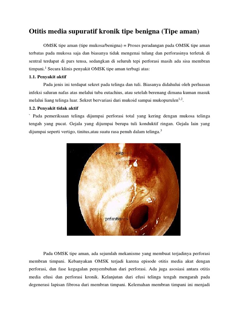 Omsk Tipe Aman | PDF | Kajian Bahasa Asing | Kesehatan Holistik