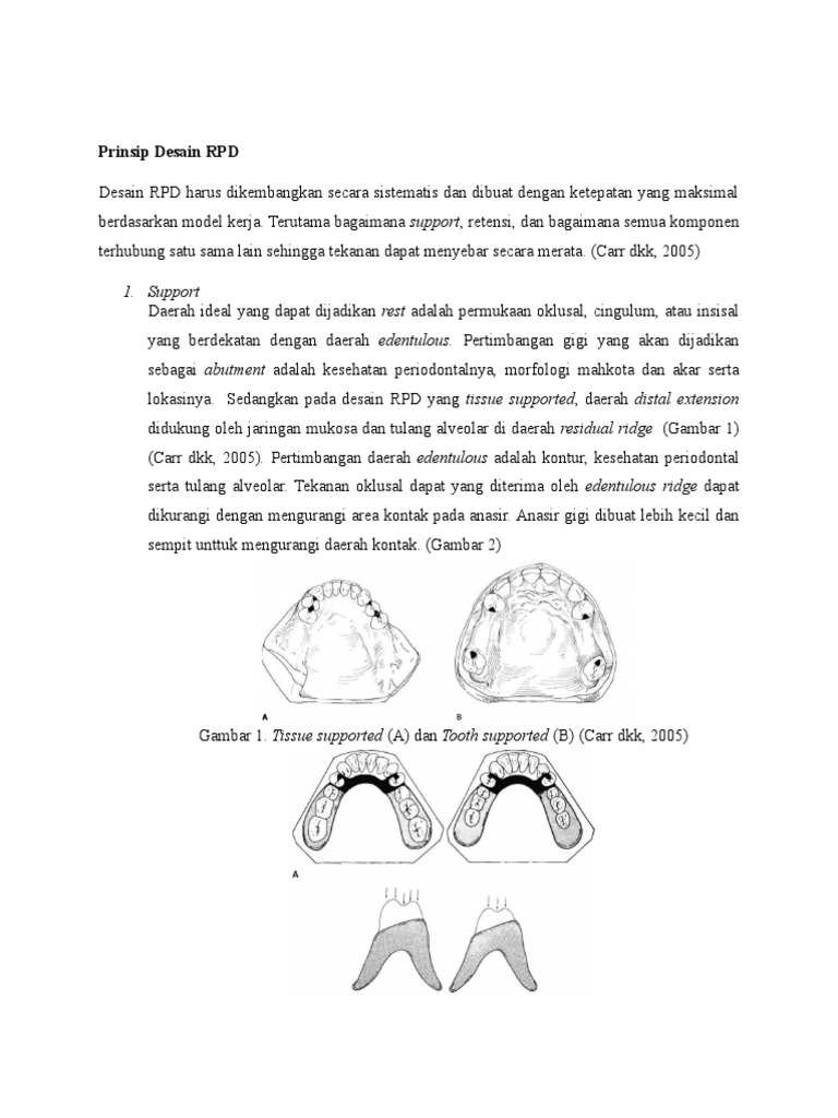 Prinsip Desain RPD - As3 | PDF