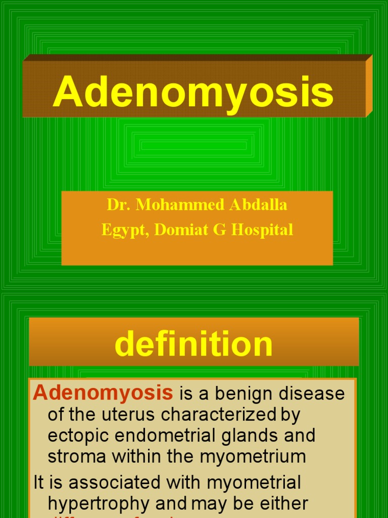 Understanding Adenomyosis: Key Insights | PDF | Menstruation | Magnetic ...