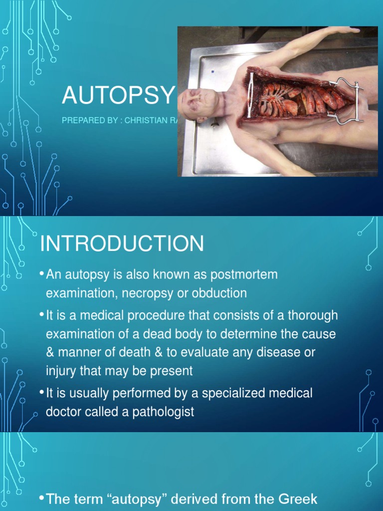 Autopsy 160626054813 | PDF | Autopsy | Death