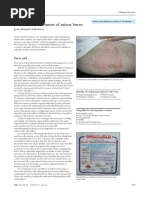 Burn Dressing Guidelines | PDF | Wound | Burn