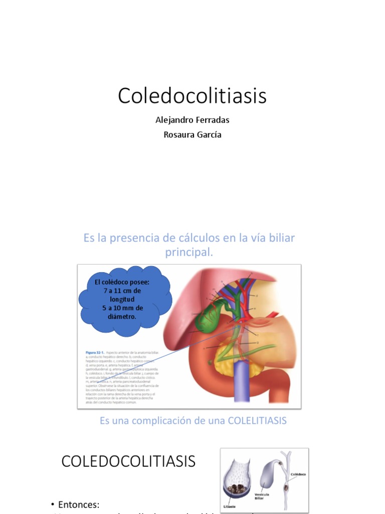 Coledocolitiasis | Vesícula biliar | Órgano (anatomía)