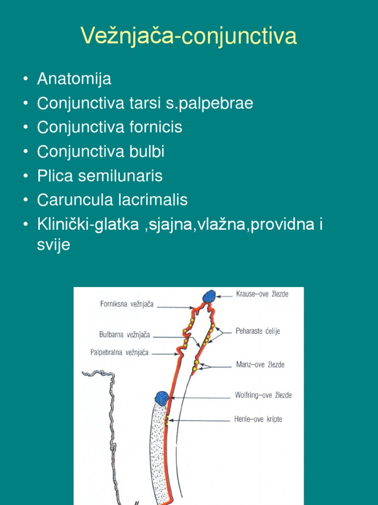 Konjunktiva i Beonjaca 4