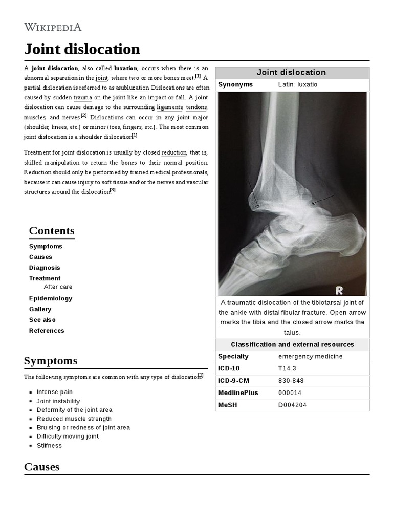 Joint Dislocation | PDF | Musculoskeletal System | Joints