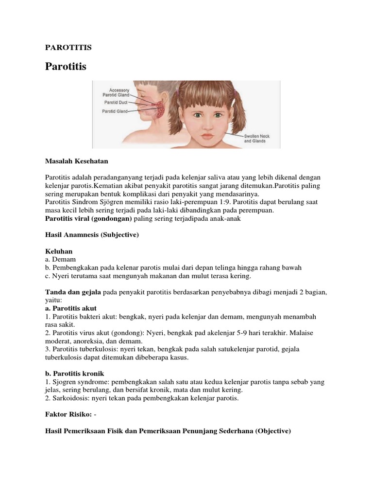 PAROTITIS | PDF