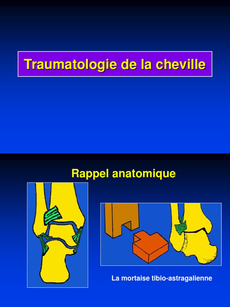 03 - Cheville Fractures | PDF | Système squelettique | Membres (anatomie)