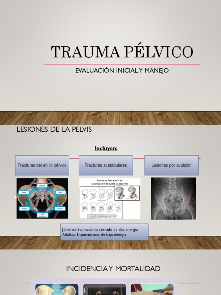 Trauma Pélvico | PDF | Pelvis | Lesión