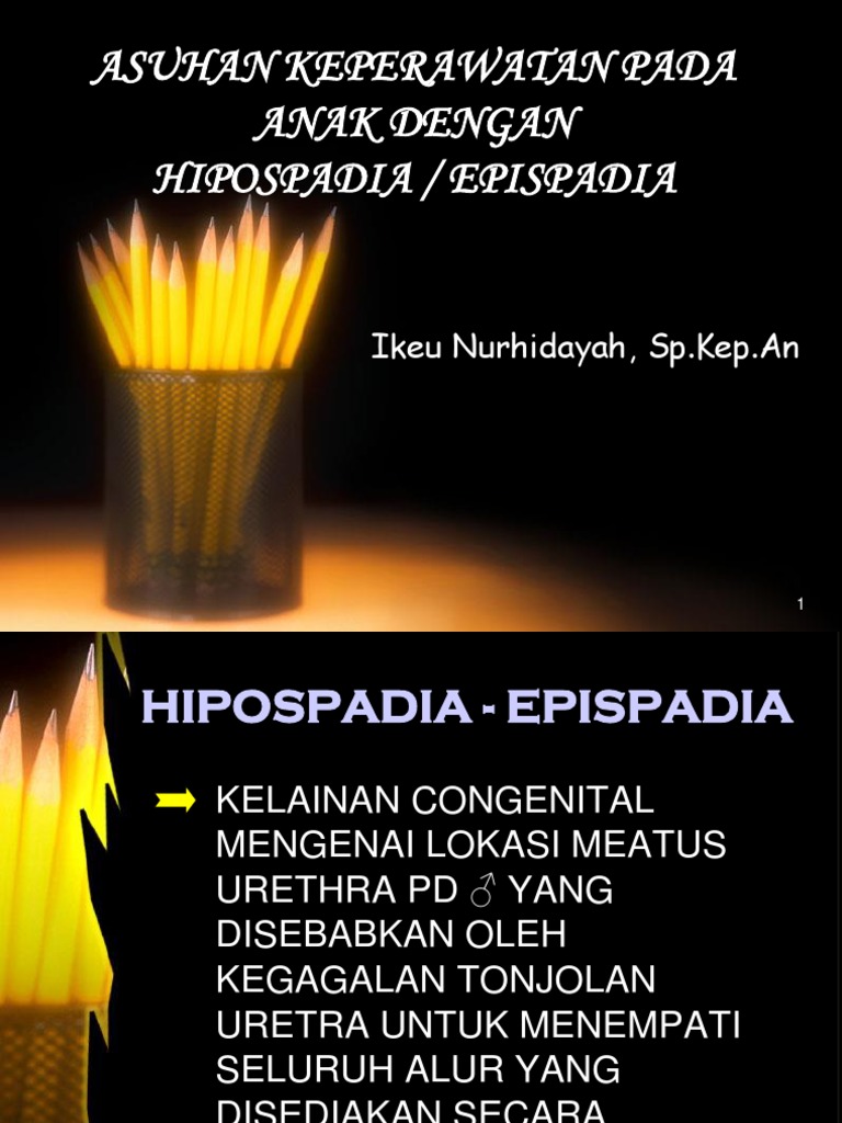 Hipospadia Epispadia PDF | PDF