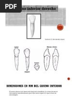 Anatomía Dentaria Temporales Incisivos | PDF | Odontología | Diente