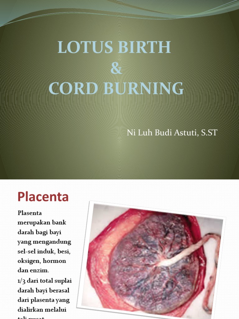 LOTUS BIRTH and Cord Burning