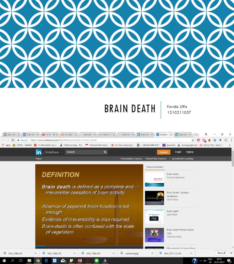Brain Death | PDF