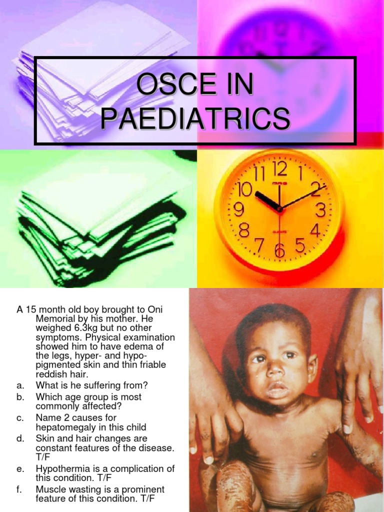 OSCE IN PAEDIATRICS: KEY DIAGNOSES AND CLINICAL FEATURES | PDF ...