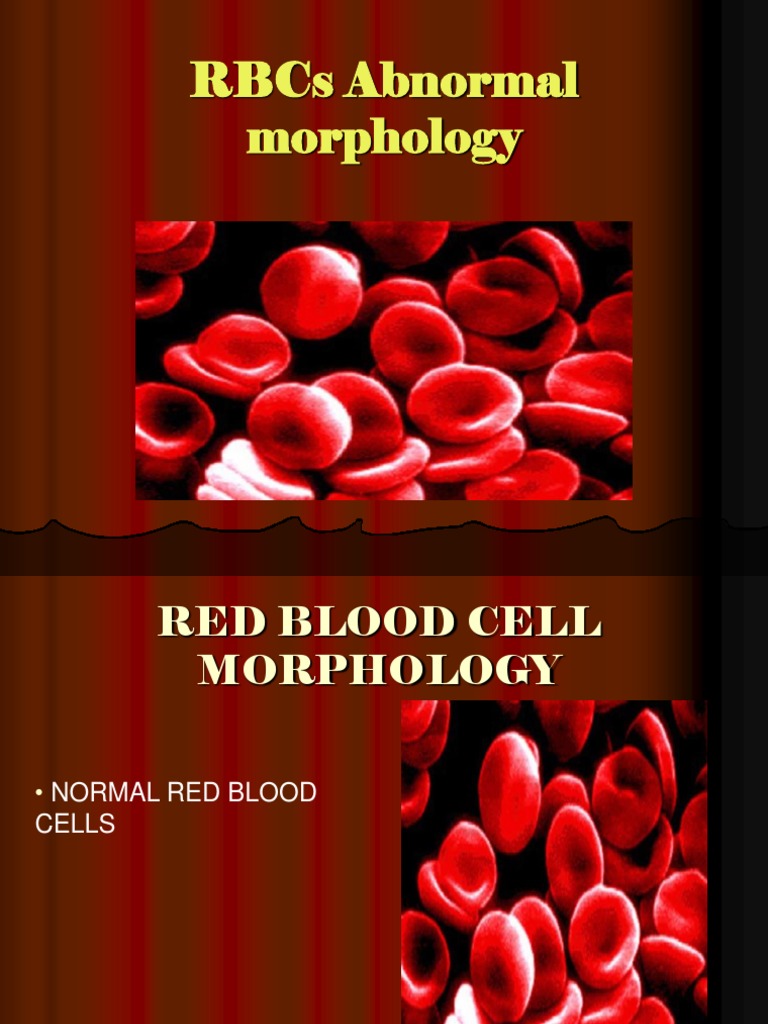 RBCs Abnormal Morphology | PDF | Anemia | Red Blood Cell