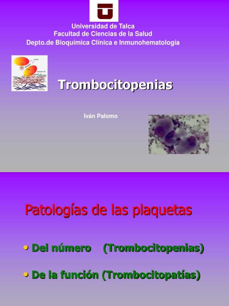 Trombocitopenias | Plaqueta | Patologia clinica
