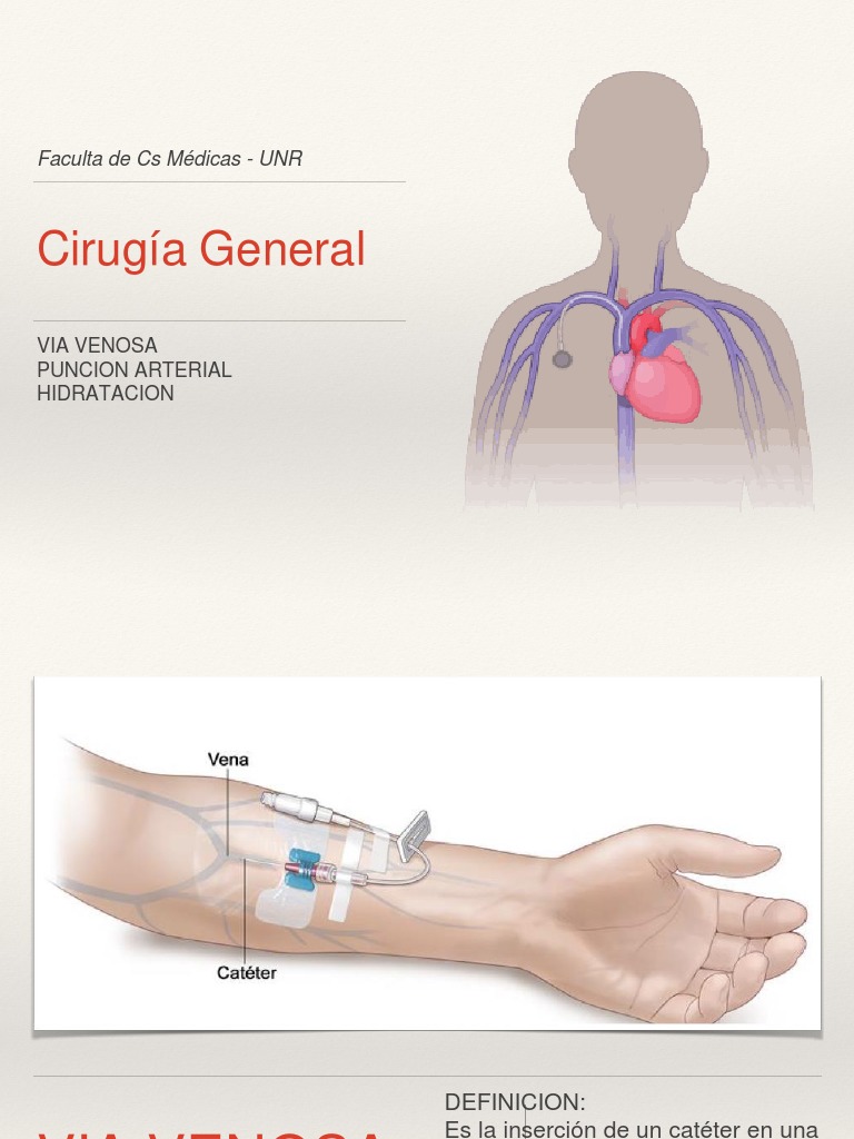 Via Venosa y Puncion Arterial | Terapia intravenosa | Especialidades ...