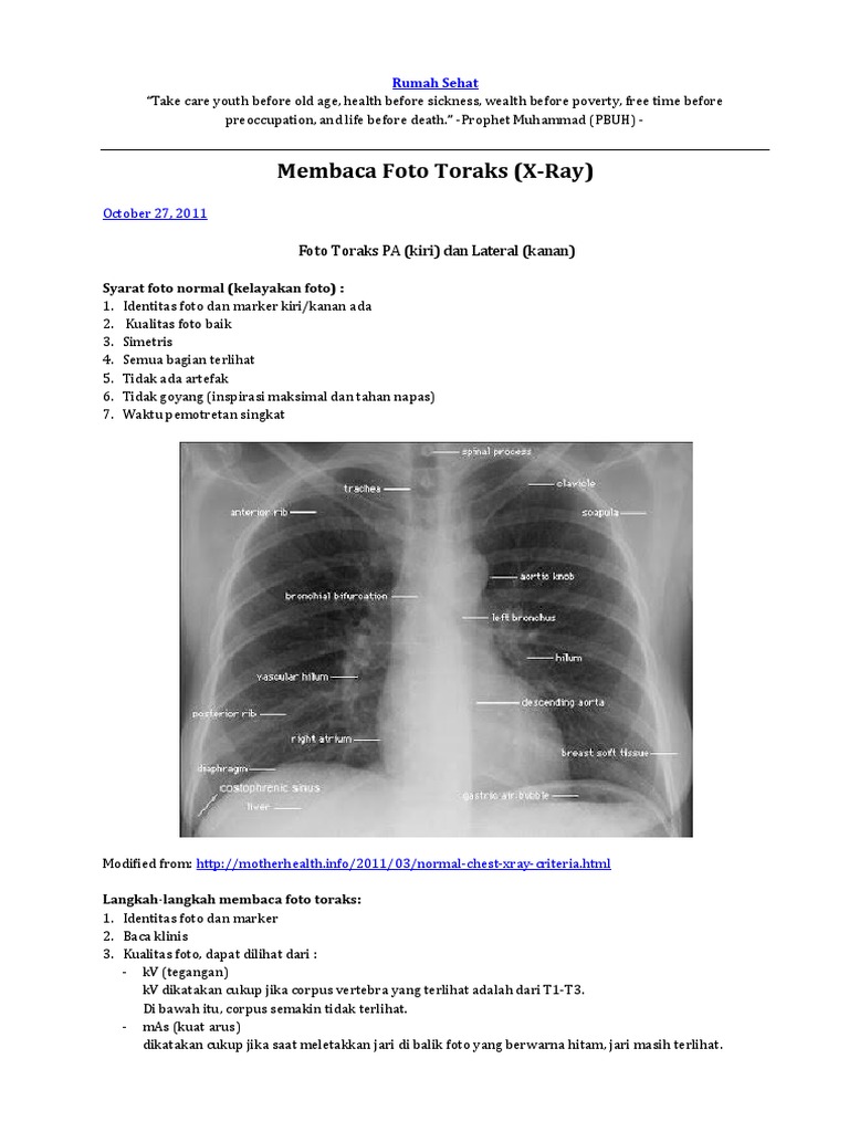 Pembacaan Rontgen Thorax | PDF
