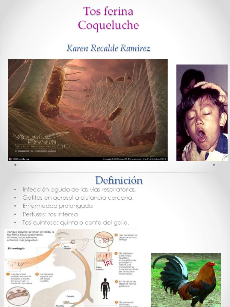 Tos Ferina: Síntomas y Tratamiento | PDF | Enfermedades animales ...