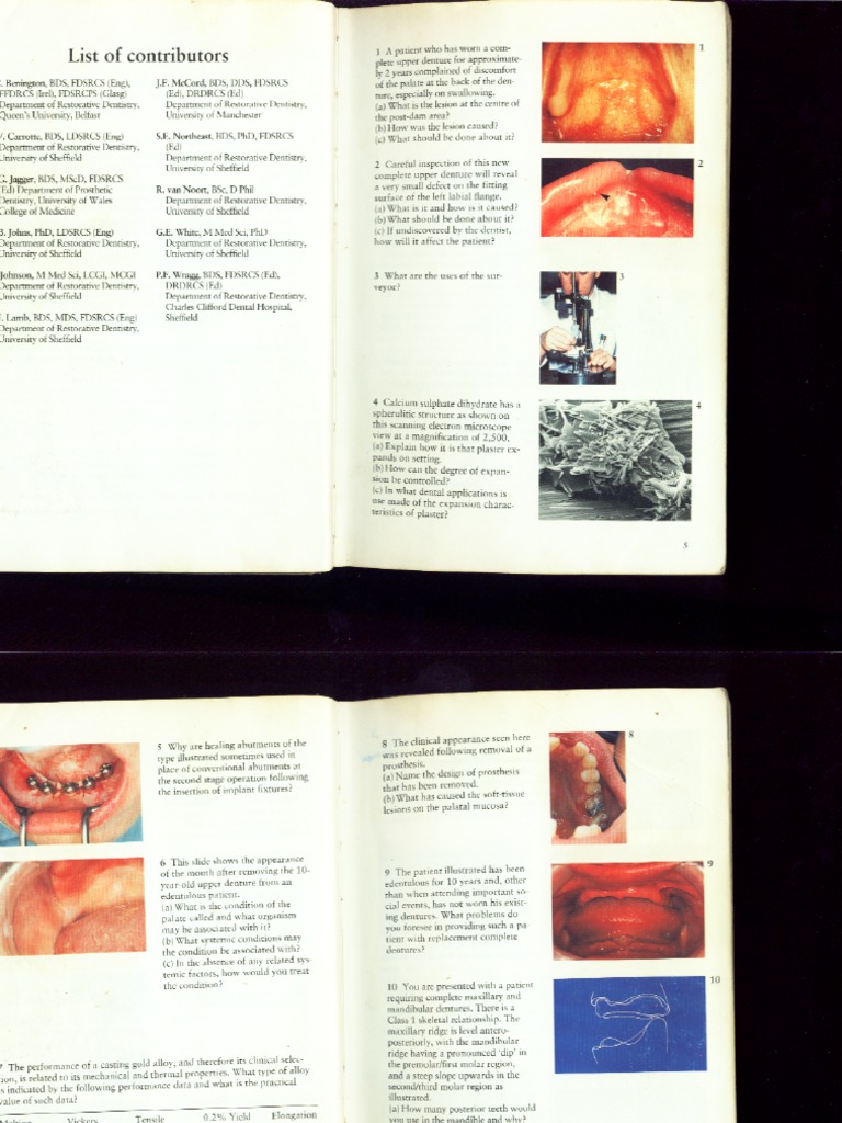Atlas of Prostho PDF | PDF
