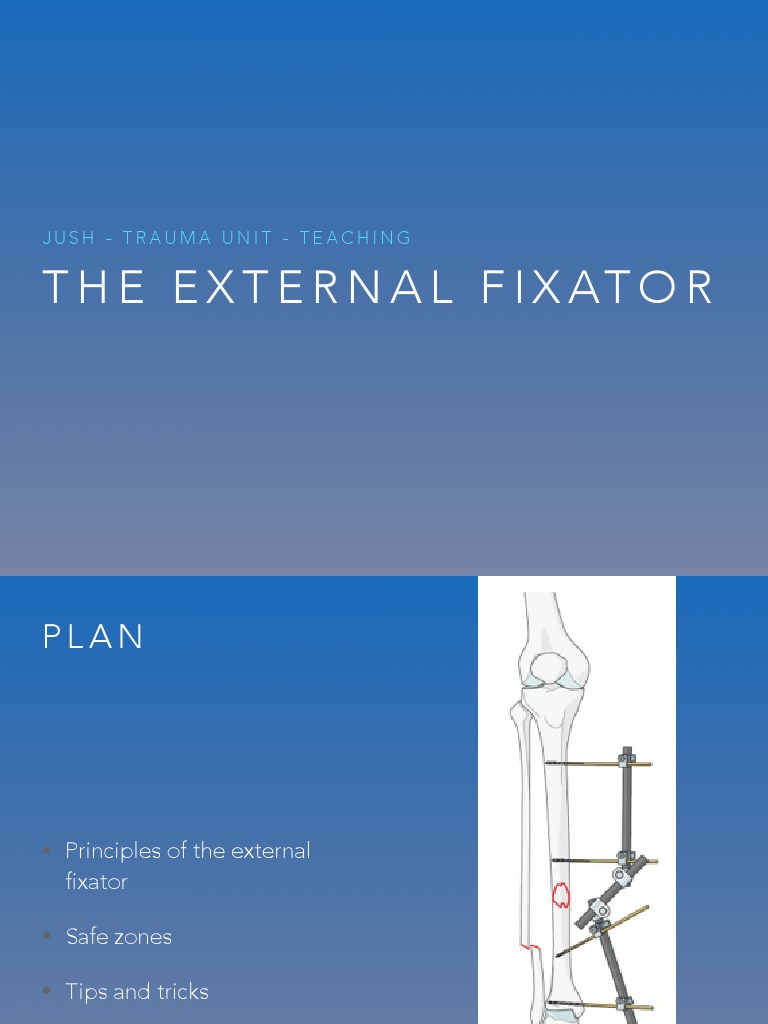 External Fixator | PDF | Anatomical Terms Of Location | Screw