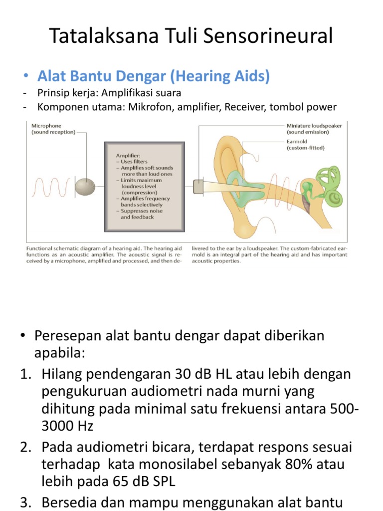 Tatalaksana Tuli Sensorineural | PDF