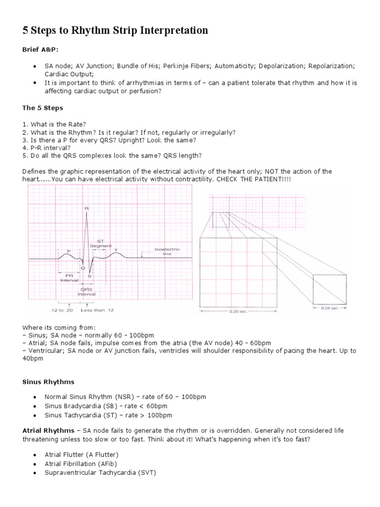 5 Steps To Rhythm Strip Interpretation | PDF | Physiology ...