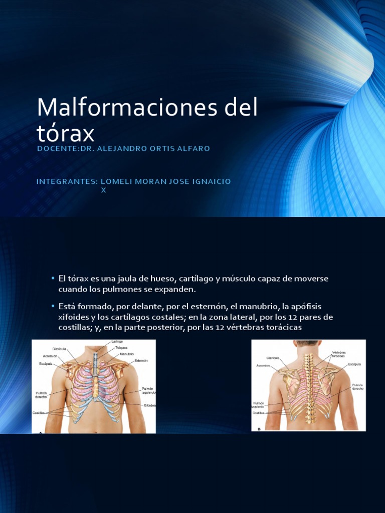 Malformaciones del Tórax | PDF | Tórax | Sistema musculoesquelético