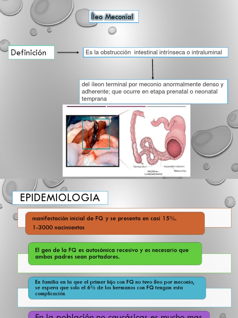Ileo Meconial | PDF | Abdomen | Especialidades Medicas