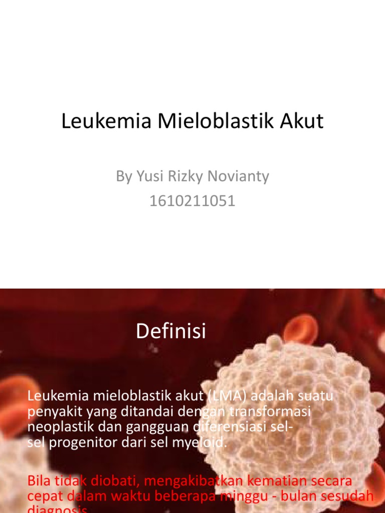 Leukemia Mieloblastik Akut | PDF