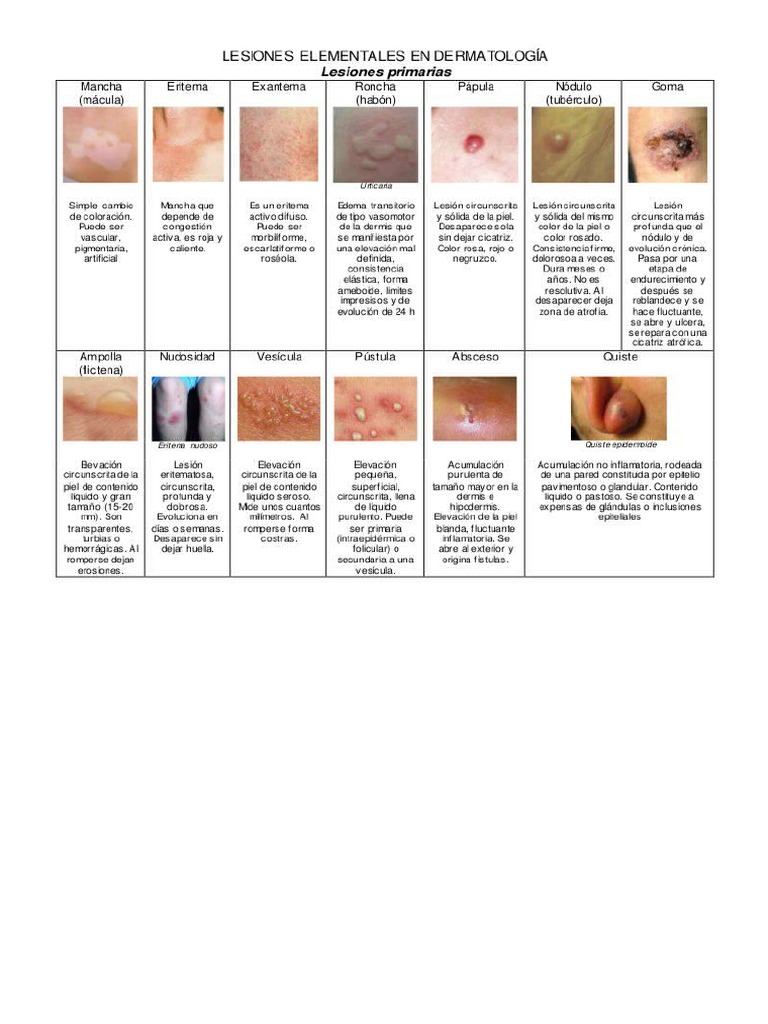 Imagenes de Lesiones Primarias y Secundarias | PDF