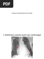 Anatomi Thorax Normal + Gambaran Radiologi | PDF