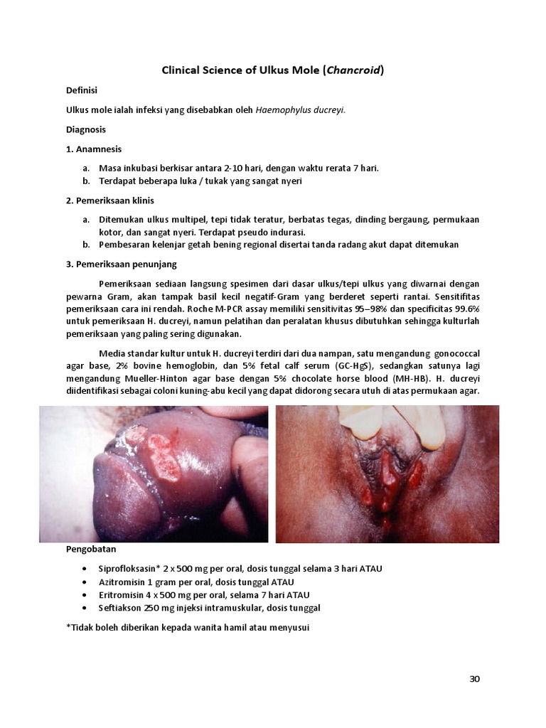 5.2 Clinical Science of Ulkus Mole | PDF | Infeksi | Spesialisasi Medis