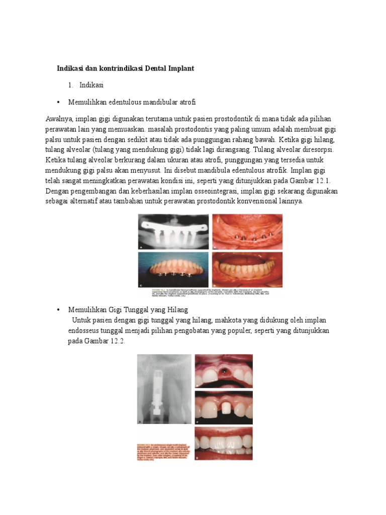 Indikasi Dan Kontrindikasi Dental Implant | PDF