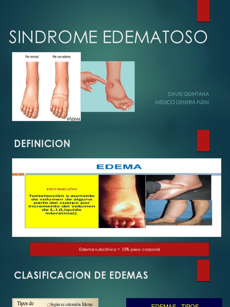 Sindrome Edematoso | PDF | Edema | Enfermedades y trastornos