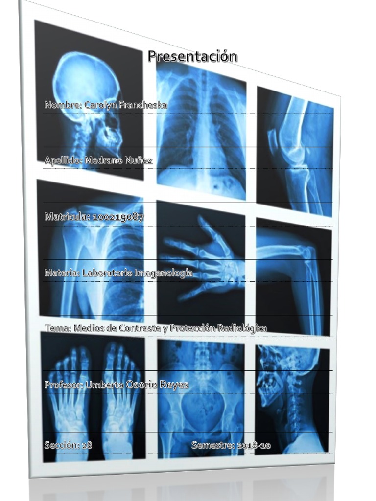 Medios de Contraste Imageneologia | PDF | Radiación ionizante | Ct Scan