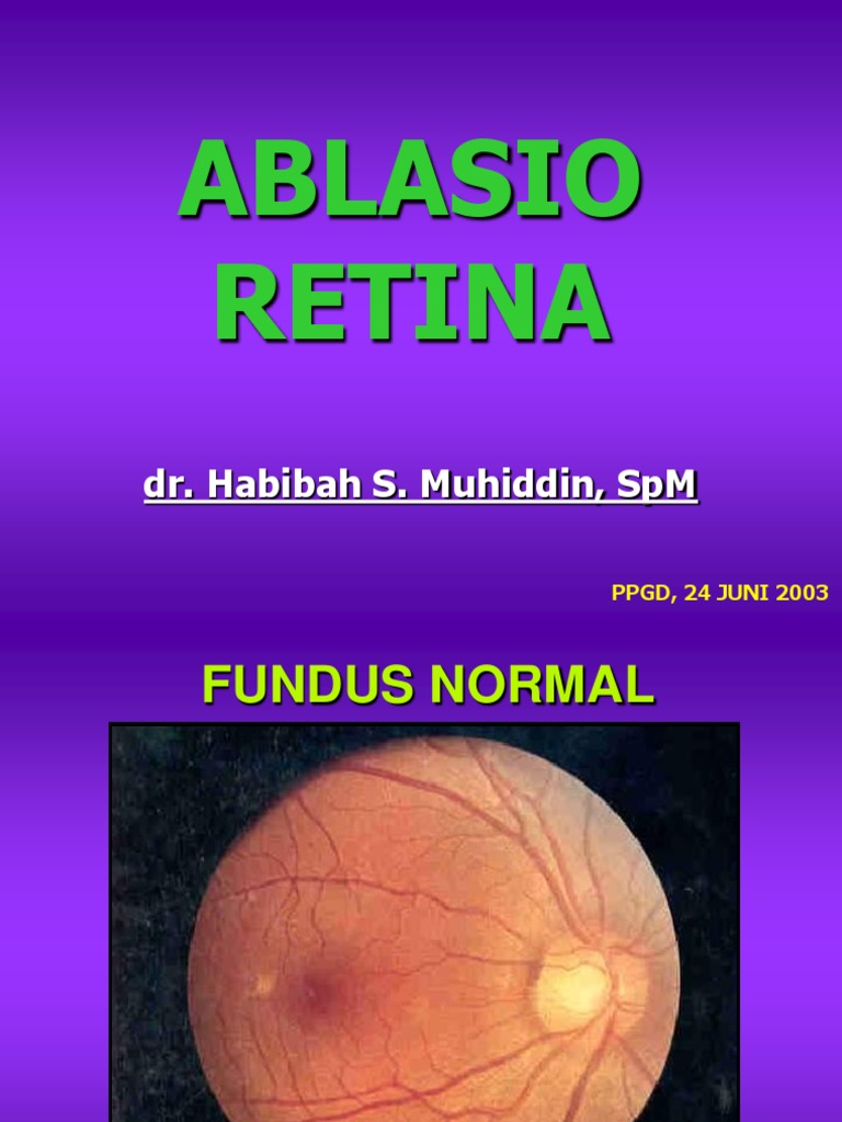 Ablasio Retina: Diagnosis & Penanganan | PDF