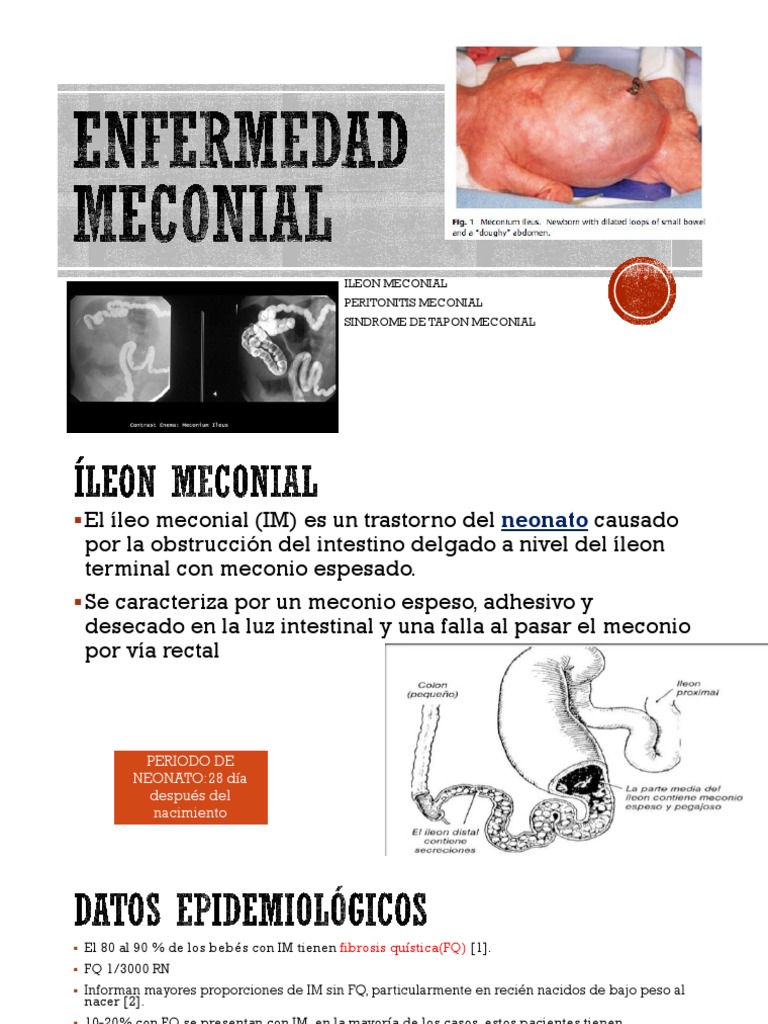 Ileon Meconial | PDF | Gastroenterología | Rtt