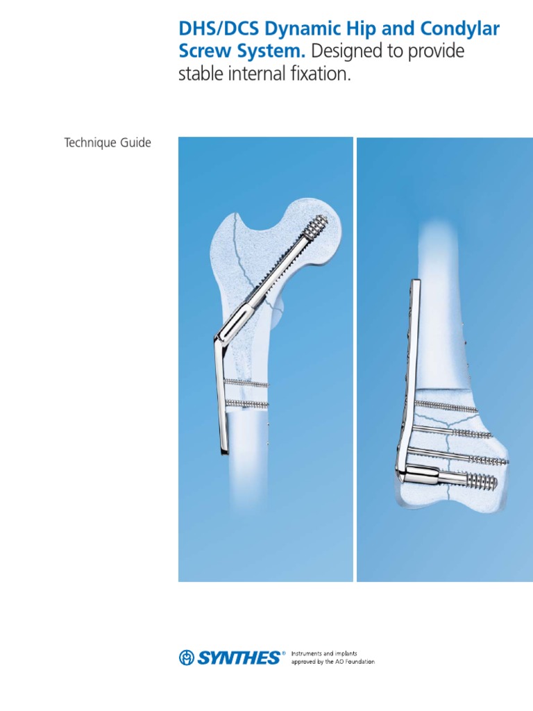 12 Dhs | PDF | Hip | Knee
