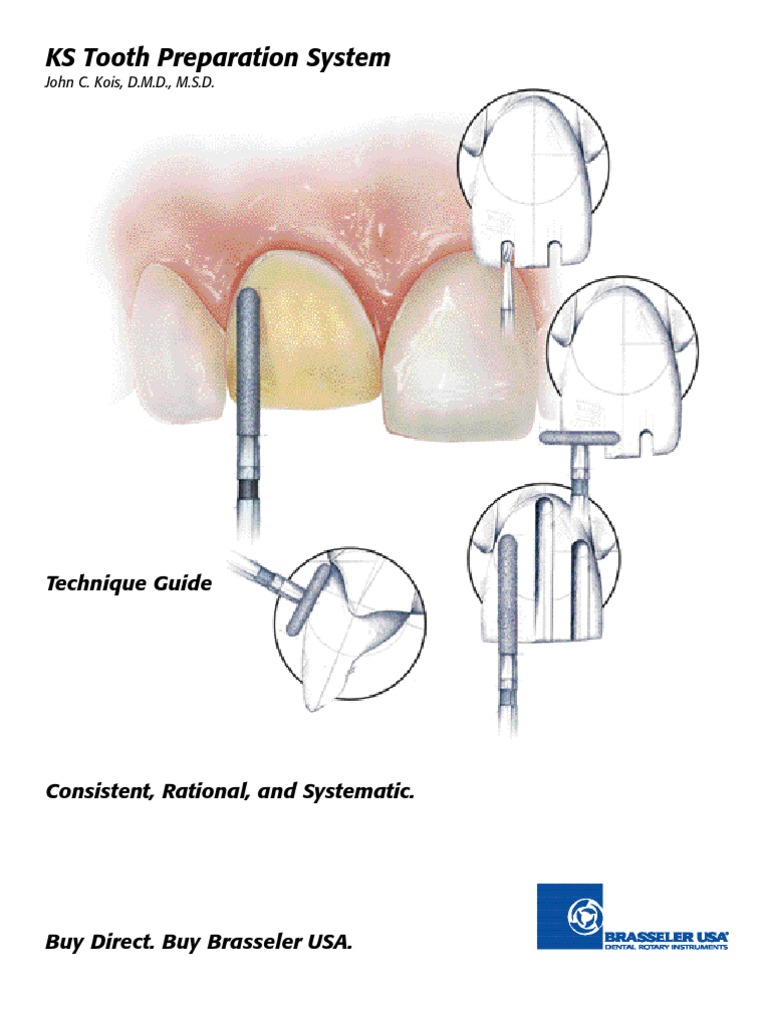 Kois - KS Tooth Prep System | PDF | Tooth | Dentistry Branches