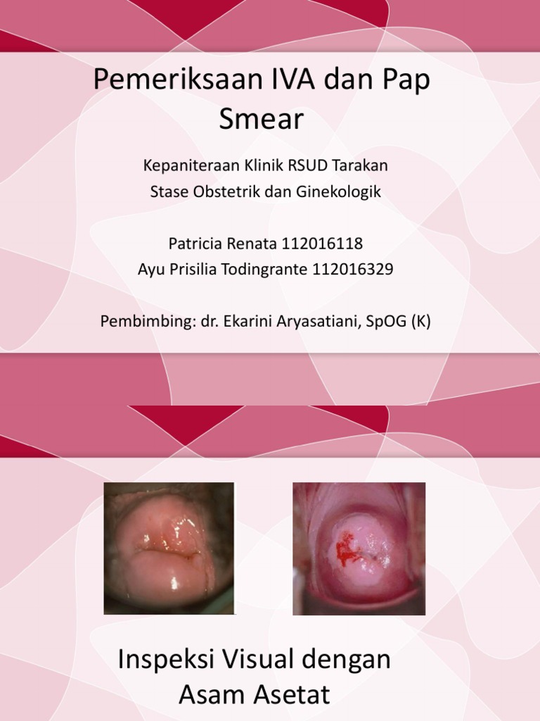 Pemeriksaan IVA Dan Pap Smear | PDF