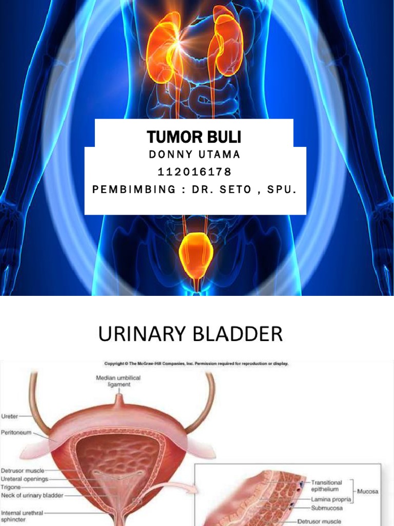 Tumor Buli | PDF